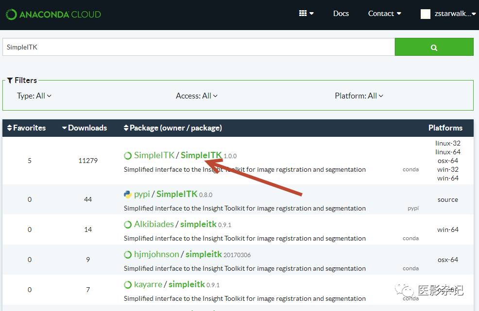 使用Anaconda搭建SimpleITK开发环境_simpleitk和anacoda-CSDN博客